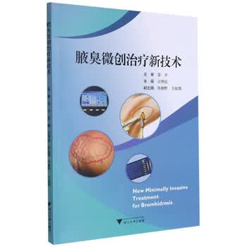 腋臭微创治疗新技术