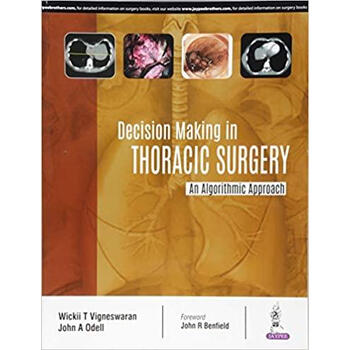 Decision Making in Thoracic Surgery
