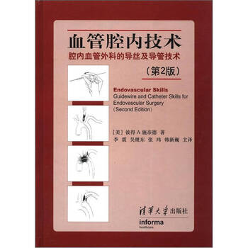 血管腔内技术腔内血管外科的导丝及导管技术 [美]彼得A施奈德（SchneiderPA） 著,李震 译