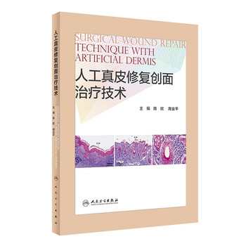 人工真皮修复创面治疗技术