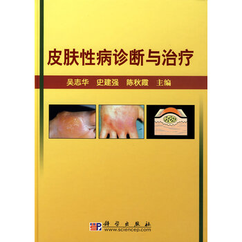 皮肤性病诊断与治疗