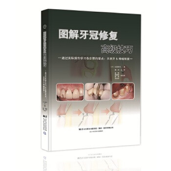 图解牙冠修复高级技巧