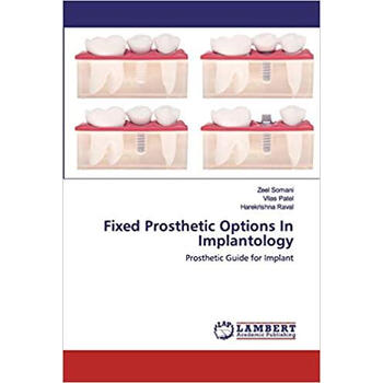 Fixed Prosthetic Options In Implantology