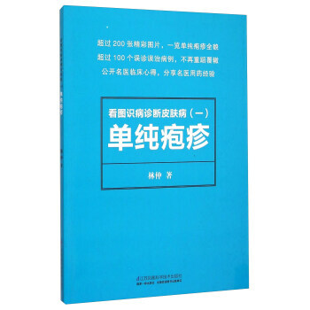 单纯疱疹