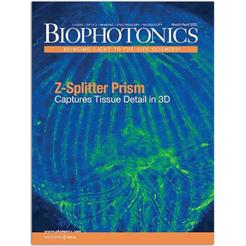 【单期可选】Biophotonics 美国生物光子学杂志 2020/21年月刊 2021年3/4月合刊