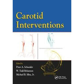Carotid Interventions