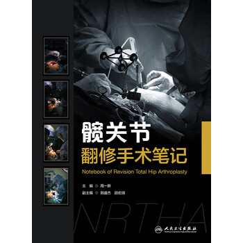 正版 髋关节翻修手术笔记 骨科医学实例书籍 髋关节置换手术指南 机器人辅助髋关节翻修技术