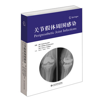 关节假体周围感染