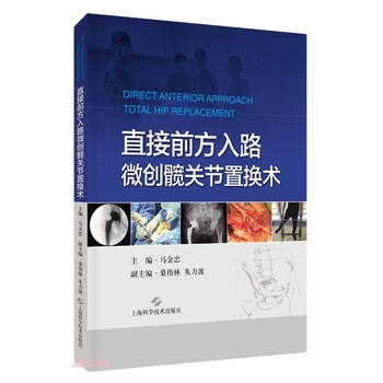 直接前方入路微创髋关节置换术
