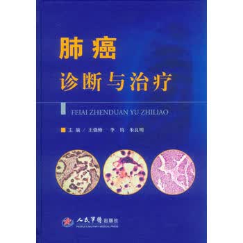 肺癌诊断与治疗 9787509162279