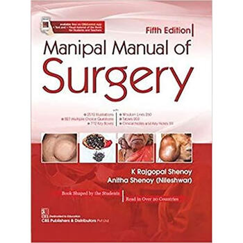 Manipal Manual of Surgery