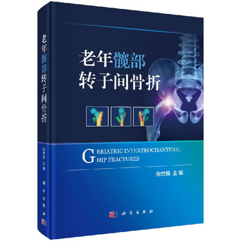 老年髋部转子间骨折/张世民