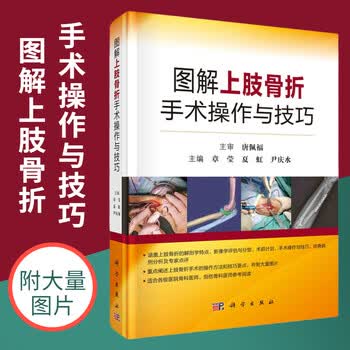 图解上肢骨折手术操作与技巧 章莹,夏虹,尹庆水 主编 科学出版社