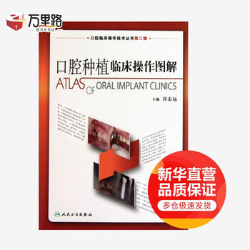 口腔种植临床操作图解(口腔临床操作技术丛书)