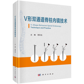 V形双通道脊柱内镜技术