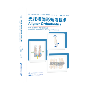 无托槽隐形矫治技术