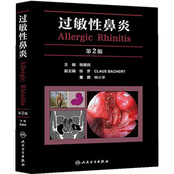 过敏性鼻炎第2版韩德民人民卫生出版