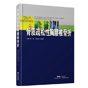 骨质疏松性胸腰椎骨折 粱德,江晓兵 广东科技出版社 9787535968227