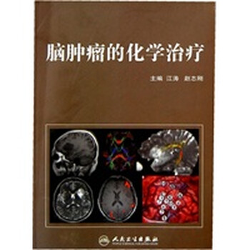 脑肿瘤的化学治疗【正版图书】