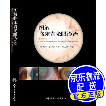 图解临床青光眼诊治