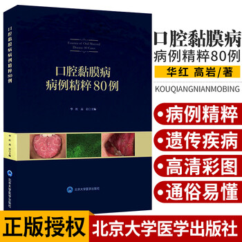 口腔黏膜病病例精粹80例 口腔医学 口腔粘膜溃疡 感染性疾病 唇舌疾病 遗传性疾病 华红 高岩著