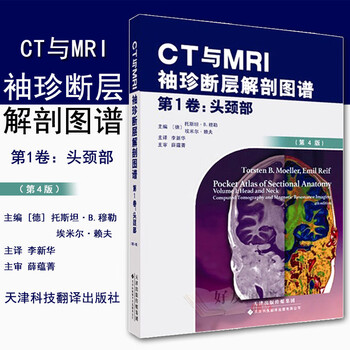 正版现书  CT与MRI袖珍断层解剖图谱（D1卷,头颈部） 埃米尔·赖夫 天津科技翻译出版有限公司
