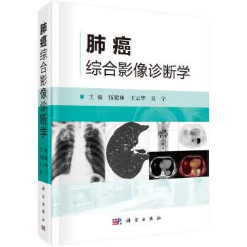 肺癌综合影像诊断学【正版图书】