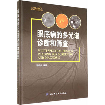 眼底病的多光谱诊断和筛查精