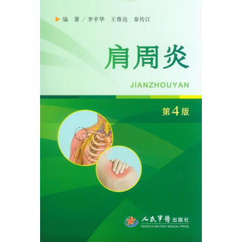 肩周炎(第四版)