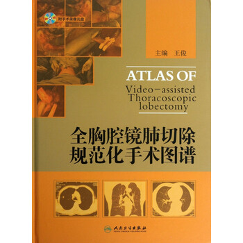 全胸腔镜肺切除规范化手术图谱(附光盘)(精)