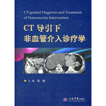 CT导引下非血管介入诊疗学