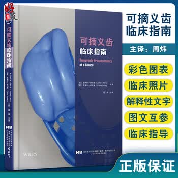 可摘义齿临床指南 对可摘义齿修复涉及问题进行了介绍全面却不肤浅关键问题都有涉及 周炜 译 9787