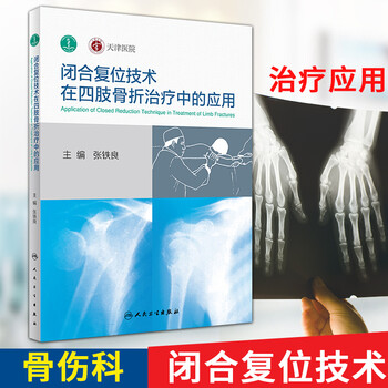 正版 闭合复位技术在四肢骨折治疗中的应用 医学 骨科 骨伤科 人民卫生出版社