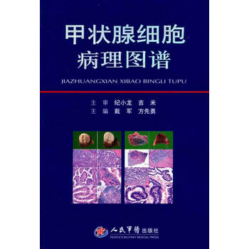 甲状腺细胞病理图谱