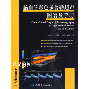脑血管彩色多普勒超声图谱及手册 （德）巴特尔斯著 中国医药科技出版社