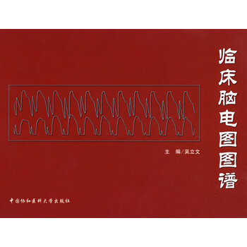 临床脑电图图谱