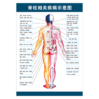 中医宣传画挂图中药配伍禁忌歌十八反十九畏歌脊柱图墙贴画WSA WSA37 脊柱相关疾病示意图 100*70厘米 覆膜防水PP贴纸