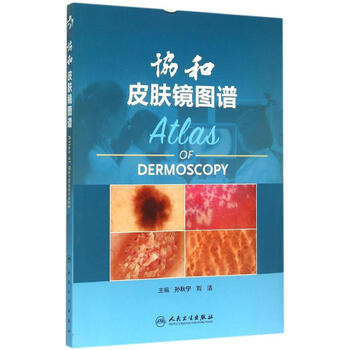 协和皮肤镜图谱 孙秋宁,刘洁 主编 著 皮肤病学与性病学 WX