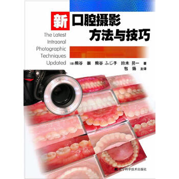 新口腔摄影方法与技巧