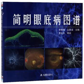 {正版新书}简明眼底病图谱9787508292489