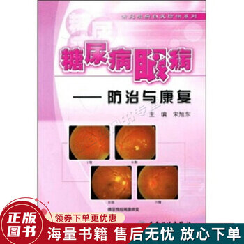 常见眼病自我防治系列·糖尿病眼病·防治与康复