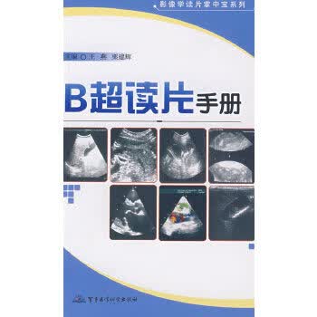 正版库存溢价  B超读片手册-影像学读片掌中宝系列 9787801219459王燕,栗建辉