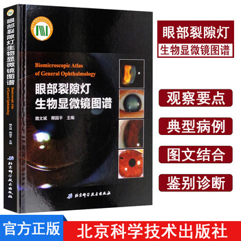 眼部裂隙灯生物显微镜图谱 同仁眼科精品图谱系列 魏文斌 卿国平著 北京科学技术出版社