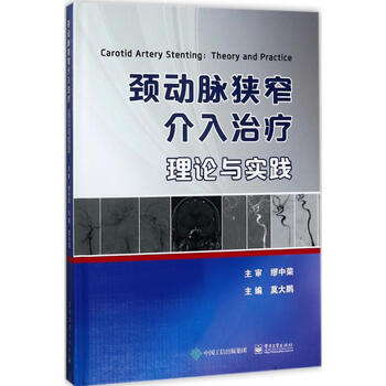 颈动脉狭窄介入治疗