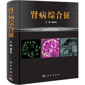 肾病综合征