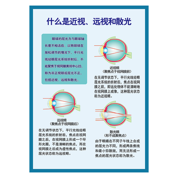 近视宣传画海报挂图保护视力远视表远视图眼睛视力训练图墙贴画覆膜贴纸SCH WST25 近视远视 100*70厘米 PP覆膜贴纸