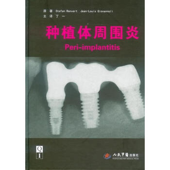 种植体周围炎 丁一　著【正版书】
