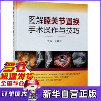 图解膝关节置换手术操作与技巧(精)