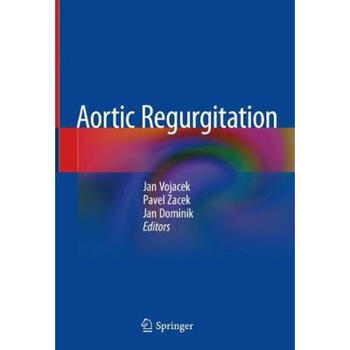 Aortic Regurgitation