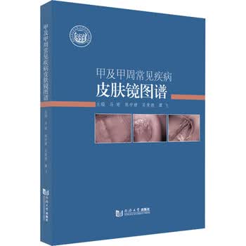 甲及甲周常见疾病皮肤镜图谱